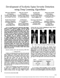 Development of Scoliotic spine severity detection using deep learning Algorithms - IIUM ...